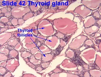 Thyroid Gland Slide Labeled